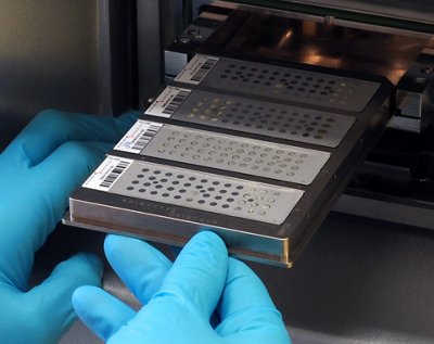 VITEK® MS | Pioneering Diagnostics